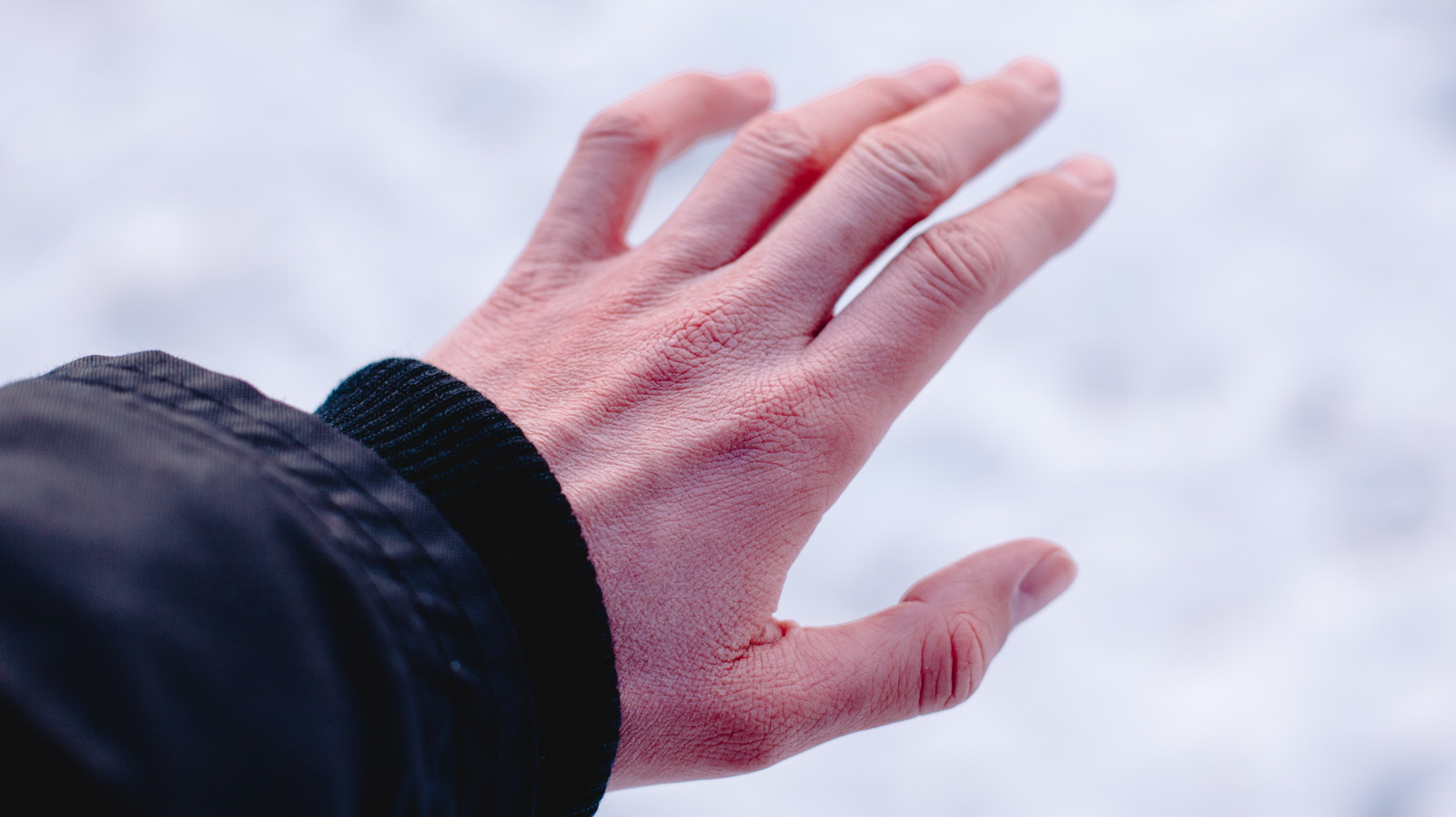 Signs Of Frostbite You Shouldn't Ignore